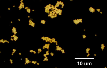 Staphylococcus Arrangement - Negative Image